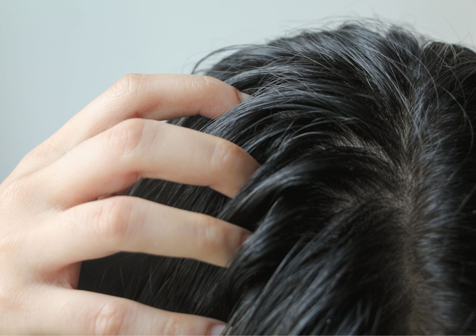 What is Sebum - Sunna Oil